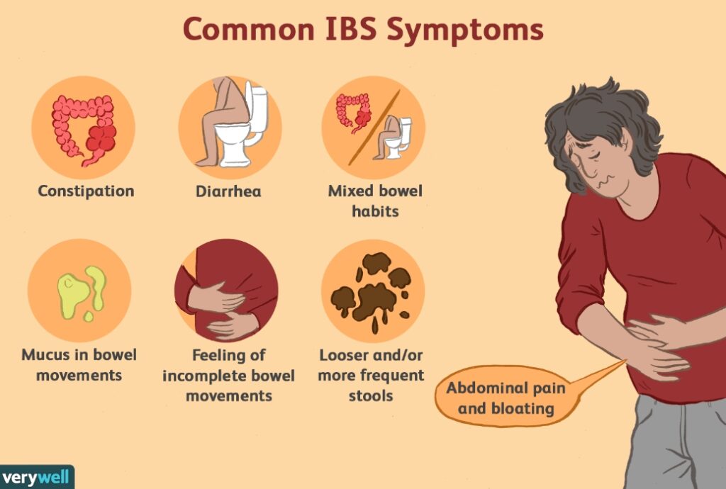 Irritable Bowel Syndrome - Dr Farah Beshoy
